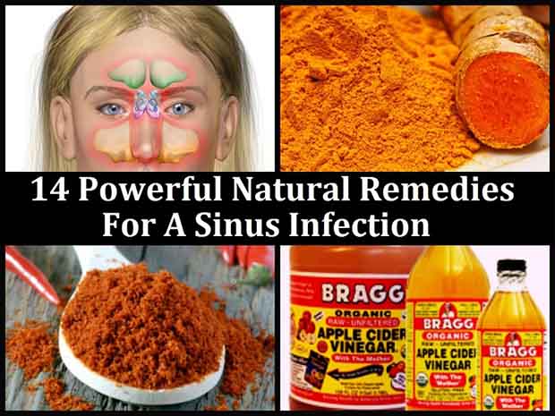 14 Powerful Natural Remedies For A Sinus Infection